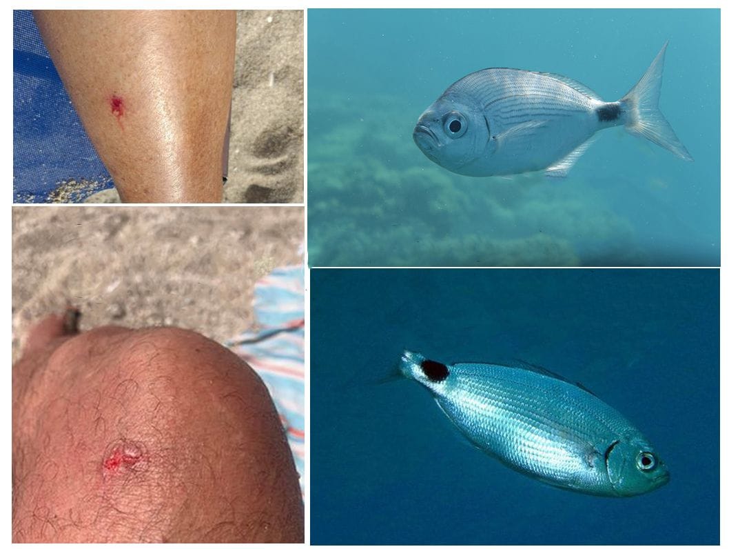 Ova vrsta ribe voli gricnuti kupače, a evo i koji ljudi bi posebno ...