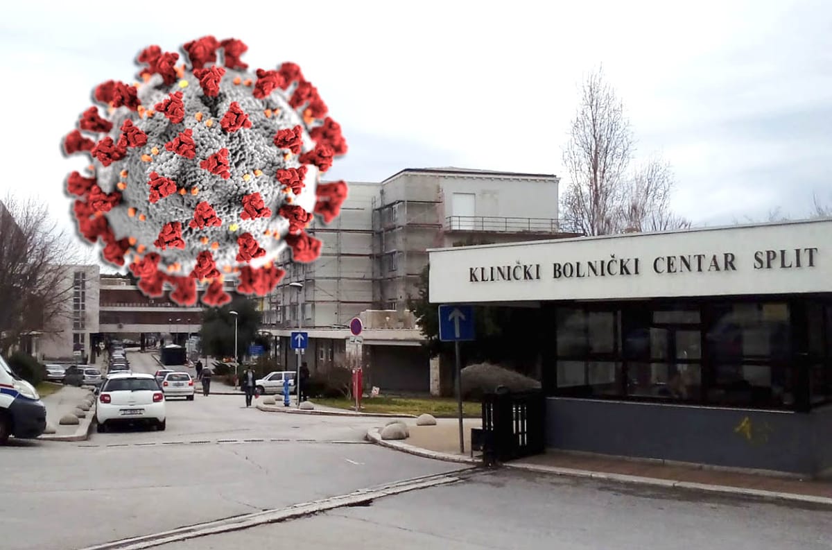 KBC Split traži 70 medicinskih sestara, javilo se samo 14 | | Morski HR